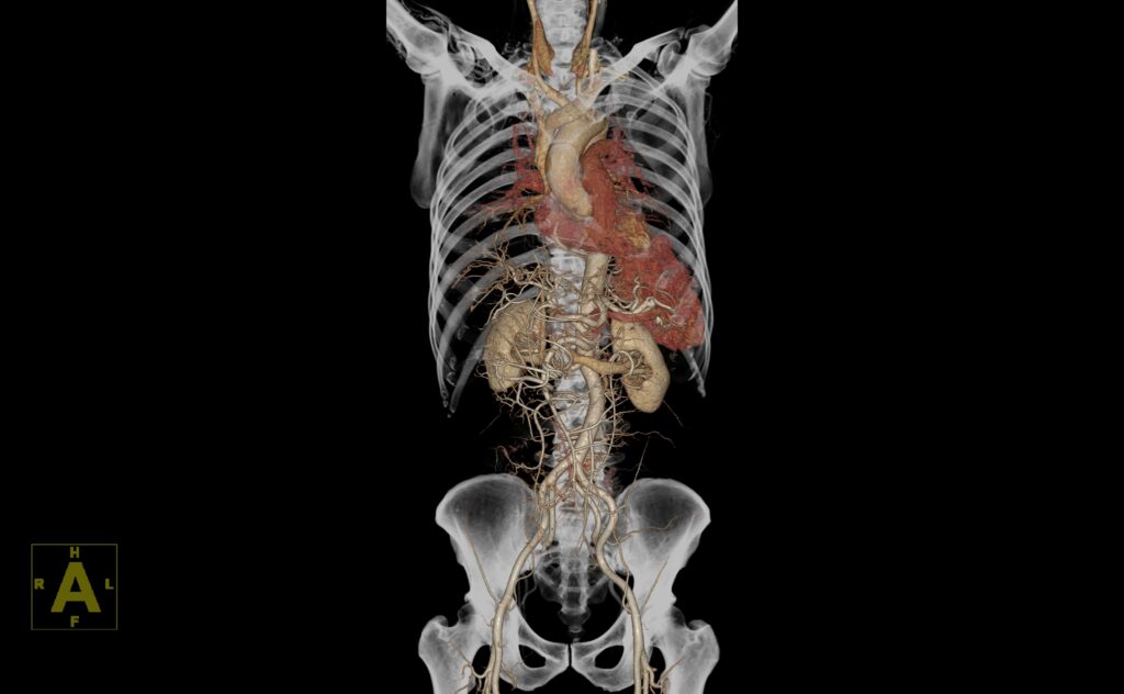 United Imaging uCT Atlas - Medical Equipment Service & Sales