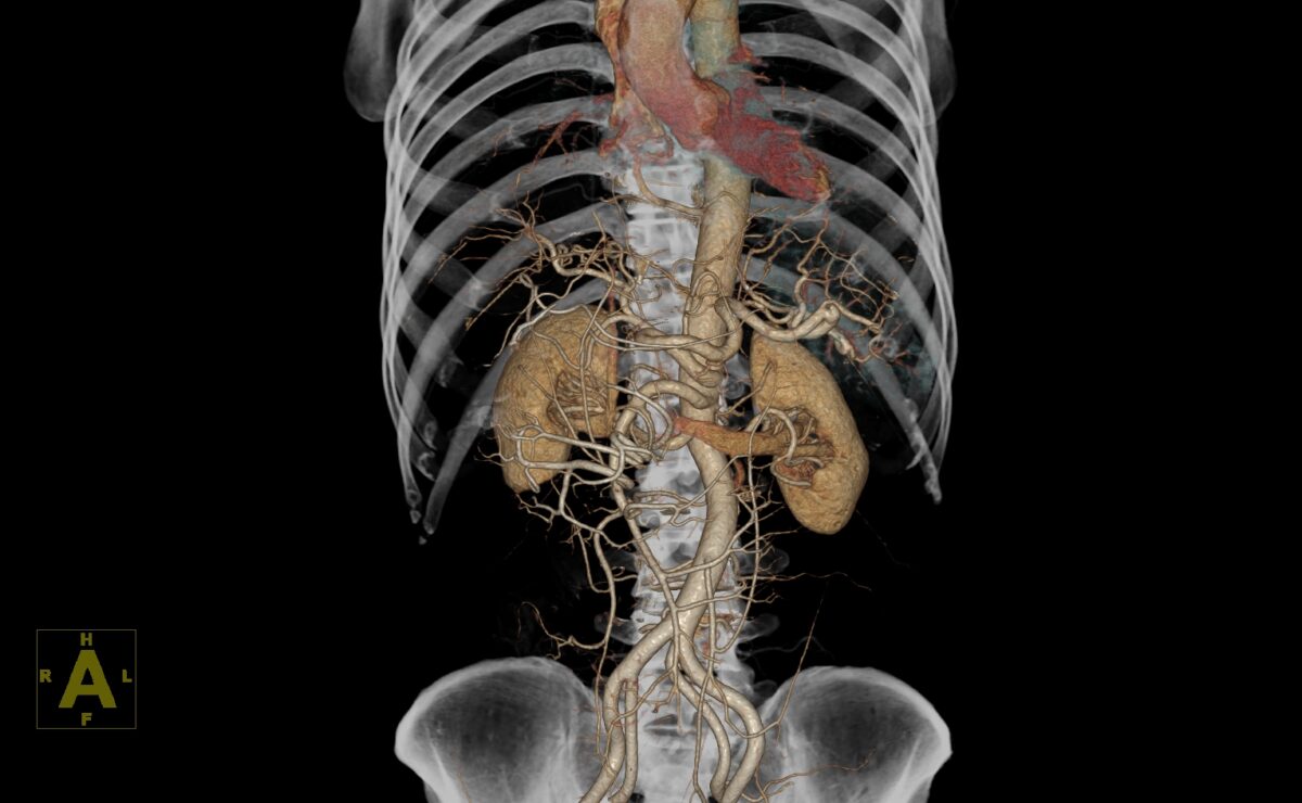 United Imaging uCT Atlas - Medical Equipment Service & Sales